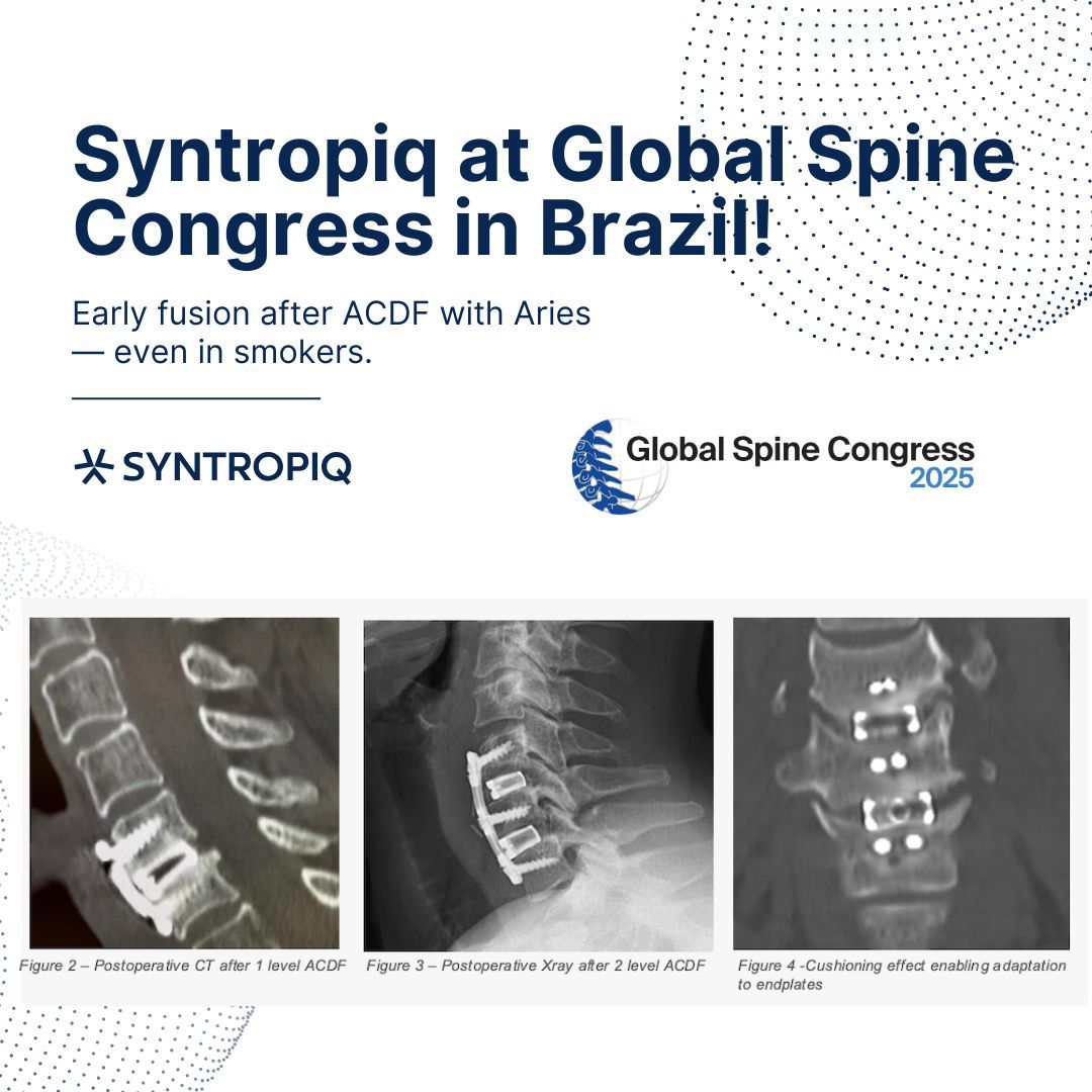 How does smoking impact early fusion outcomes after ACDF? – Syntropiq